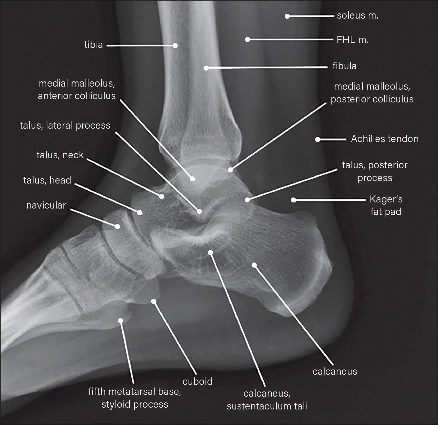Common Childhood Musculoskeletal Injuries - Musculoskeletal Issues in ...