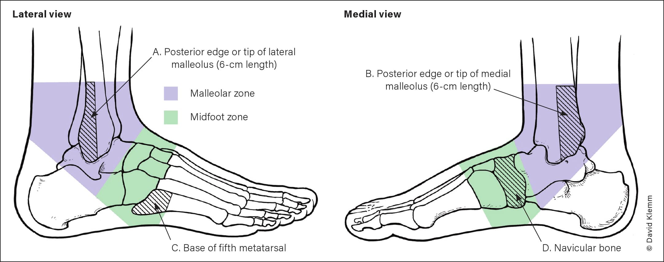 Fracture Management - Musculoskeletal Treatments | FP Essentials