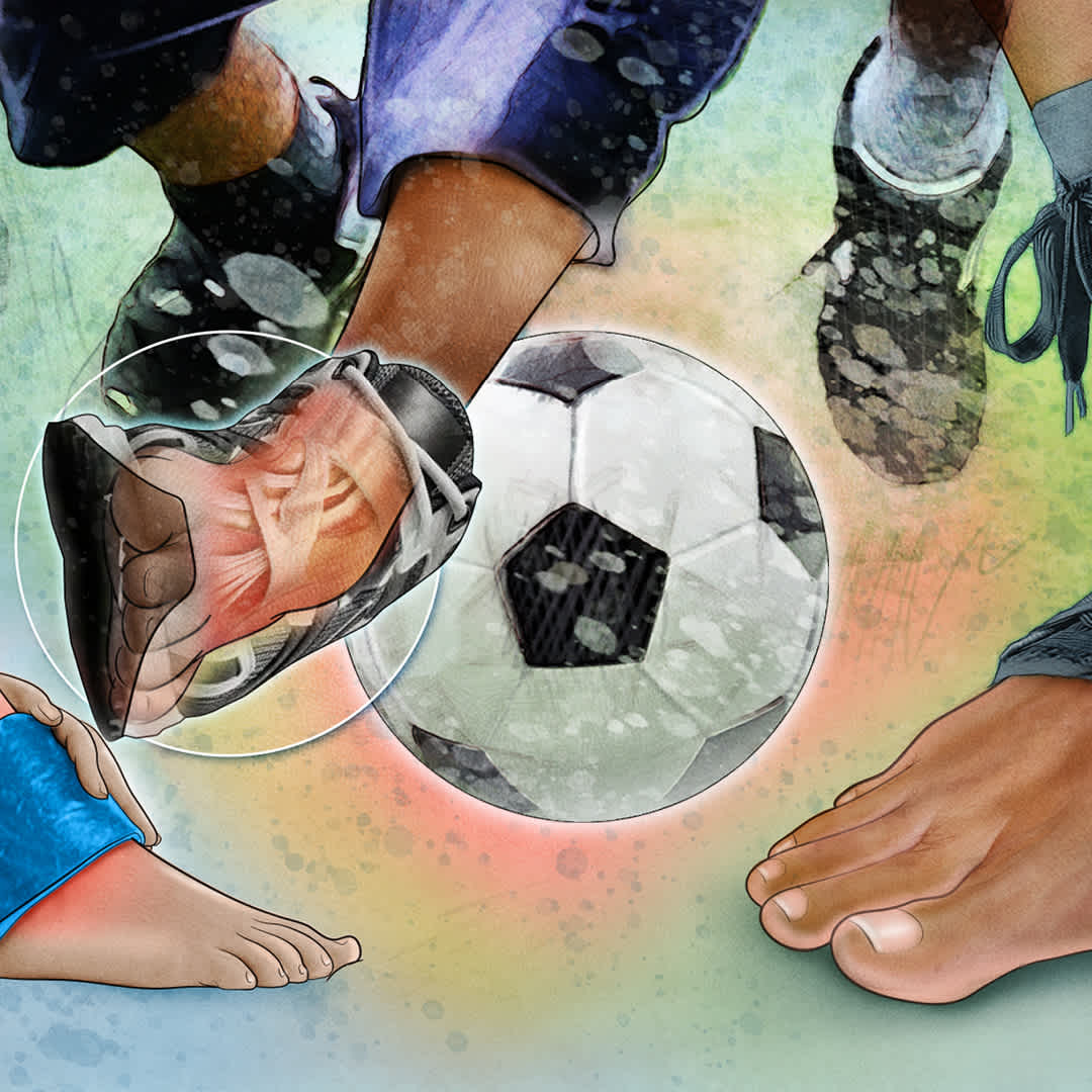Management of Acute Ankle Sprains: Common Questions and Answers | AFP