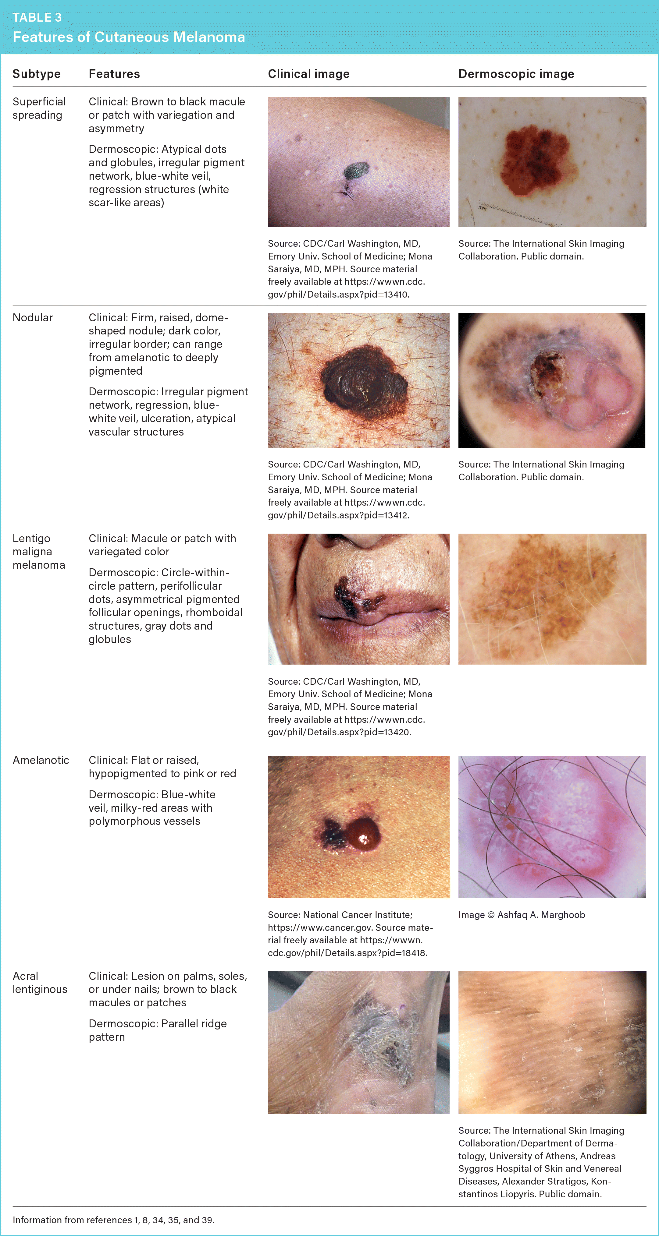 Diagnosis - Skin Cancer | FP Essentials